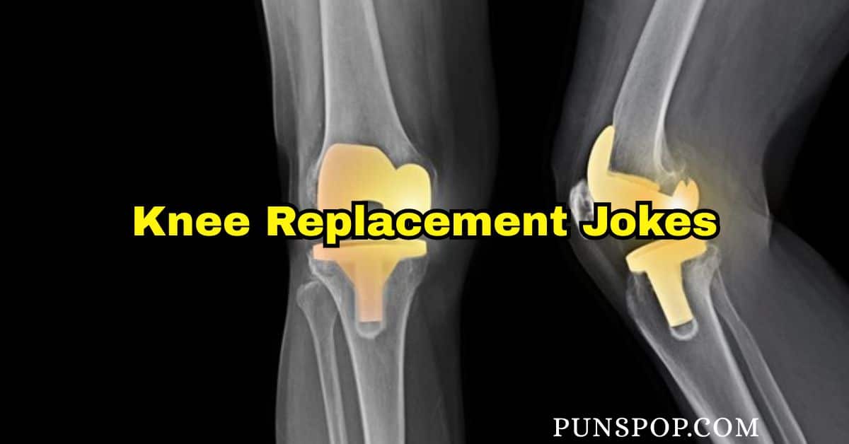 65+ Knee Replacement Jokes That’ll Crack You Up 😄🦿